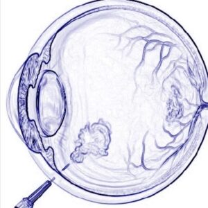 inyecciones intravítreas - Instituto Oftalmológico Recoletas