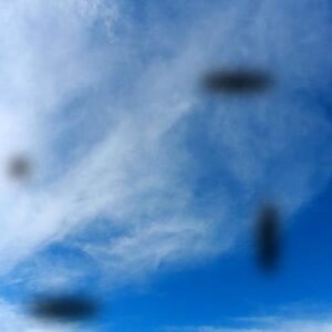 Miodesopsias - Instituto Oftalmológico Recoletas