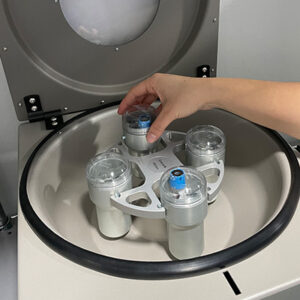 PRGF-Endoret - Instituto Oftalmológico Recoletas